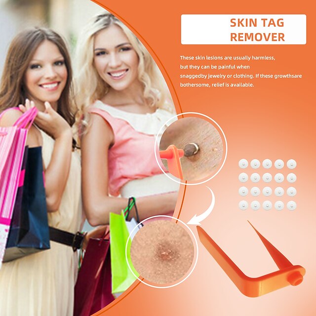 Painless Safe Skin Tag Remove Device Kit Micro Tags Size (2mm to 4mm ...