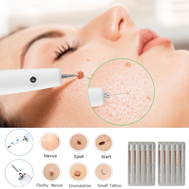 Skin Tag Remover 15 Level Laser Plasma Pen Freckle Mole Warts Removal ...