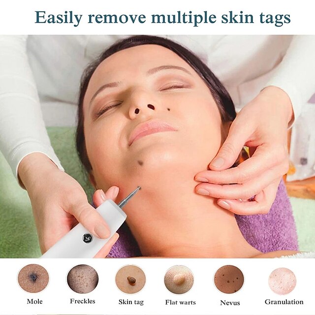 Skin Tag Remover 15 Level Laser Plasma Pen Freckle Mole Warts Removal ...