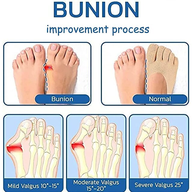 Orthoes Bunion Relief Socks Women - Orthopedic Toe Compression Sock ...