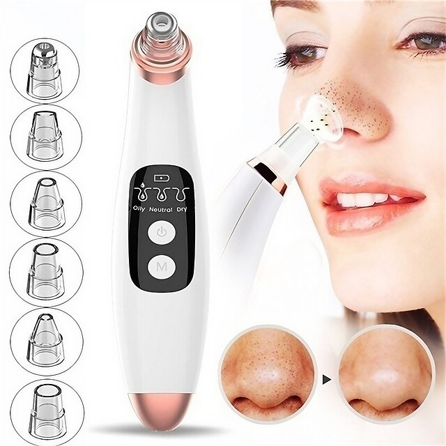 Wireless Electric Blackhead Remover Pore Vacuum Acne Pimple Removal ...
