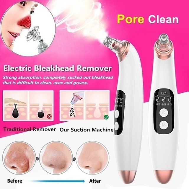 Wireless Electric Blackhead Remover Pore Vacuum Acne Pimple Removal ...