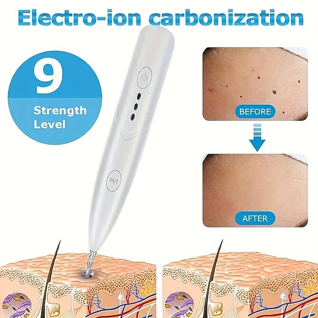 Freckle, Wart, Mole, And Skin Tag Removal Pen - Get Spotless Skin With ...